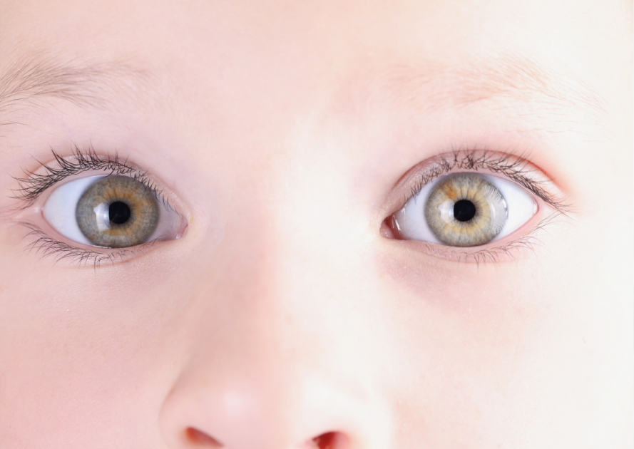 Nisztagmus, szemizom-bénulás, kettős látás: alapfogalmak